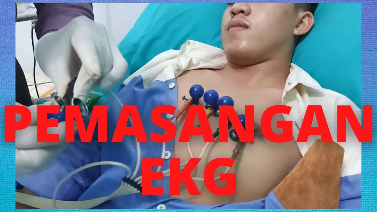 Cara Pasang EKG: Panduan Lengkap dengan Langkah-langkah Sederhana - Spirit Kawanua News